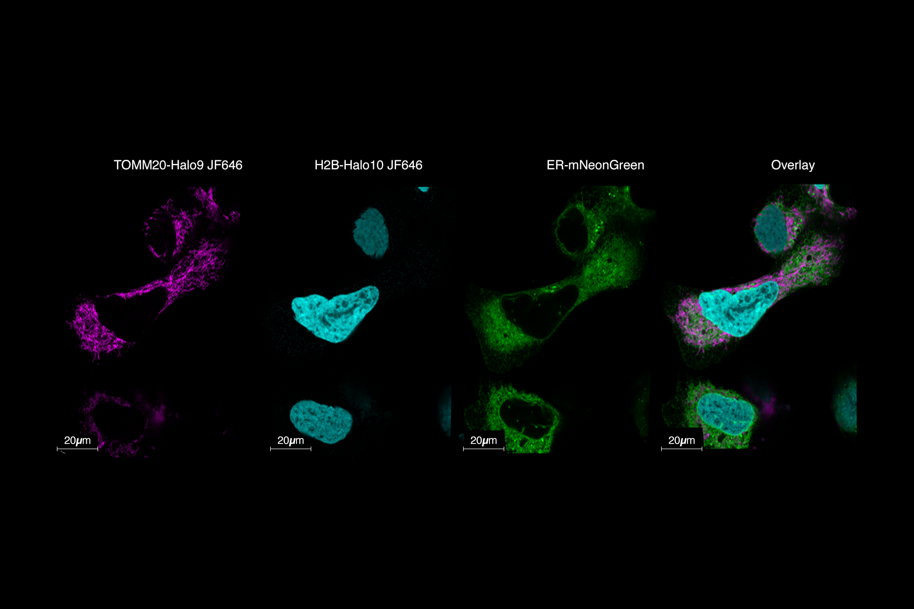 Live cell imaging of immortalized osteosarcoma cell line using the ...